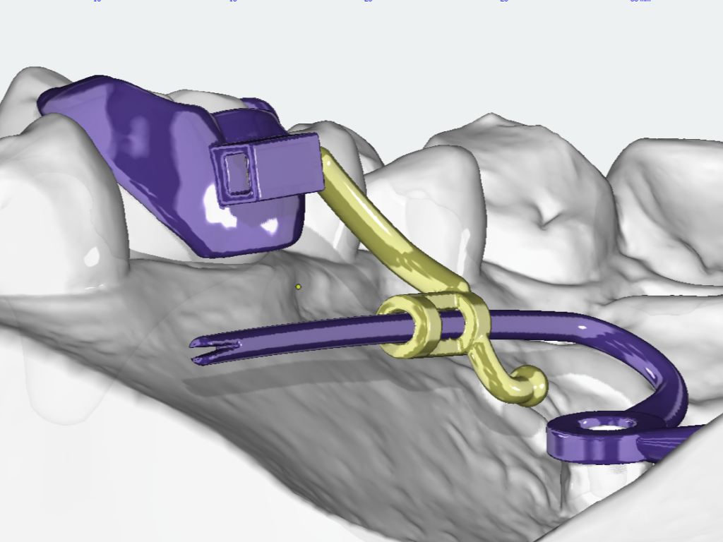 CAD-LABS | Beneslider
